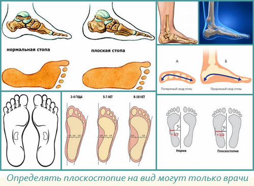 Упражнения для лечения и профилактики плоскостопия - Движение – жизнь ...